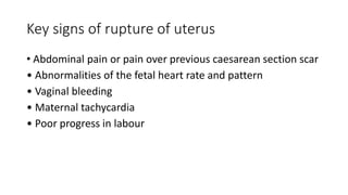 13 Uterine rupture presentation.pptx
