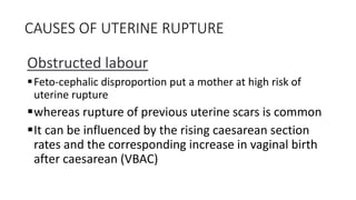 13 Uterine rupture presentation.pptx