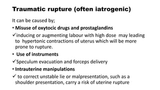 13 Uterine rupture presentation.pptx