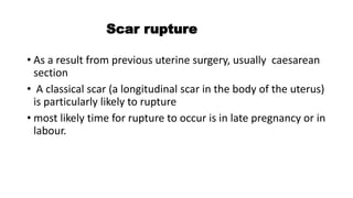 13 Uterine rupture presentation.pptx