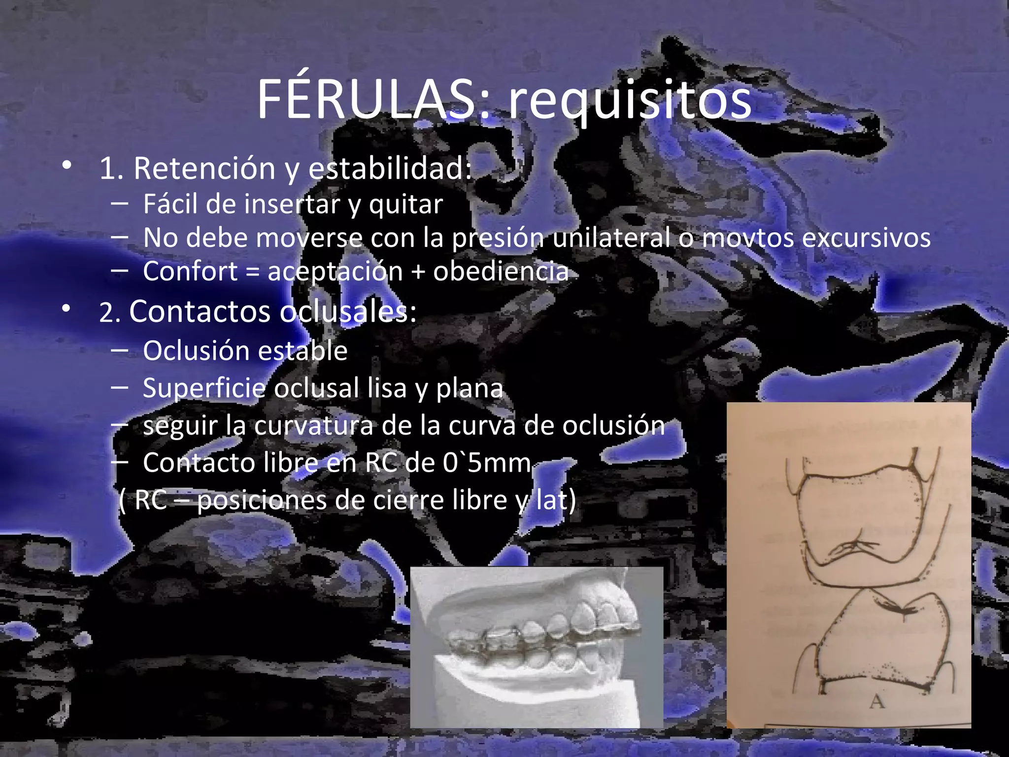 Guía clinica férulas oclusales | PPT