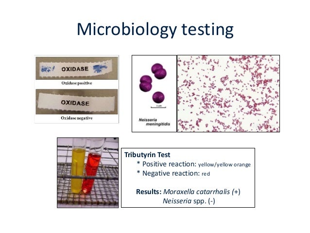 Professor Martin Maiden @ MRF's Meningitis & Septicaemia in Children