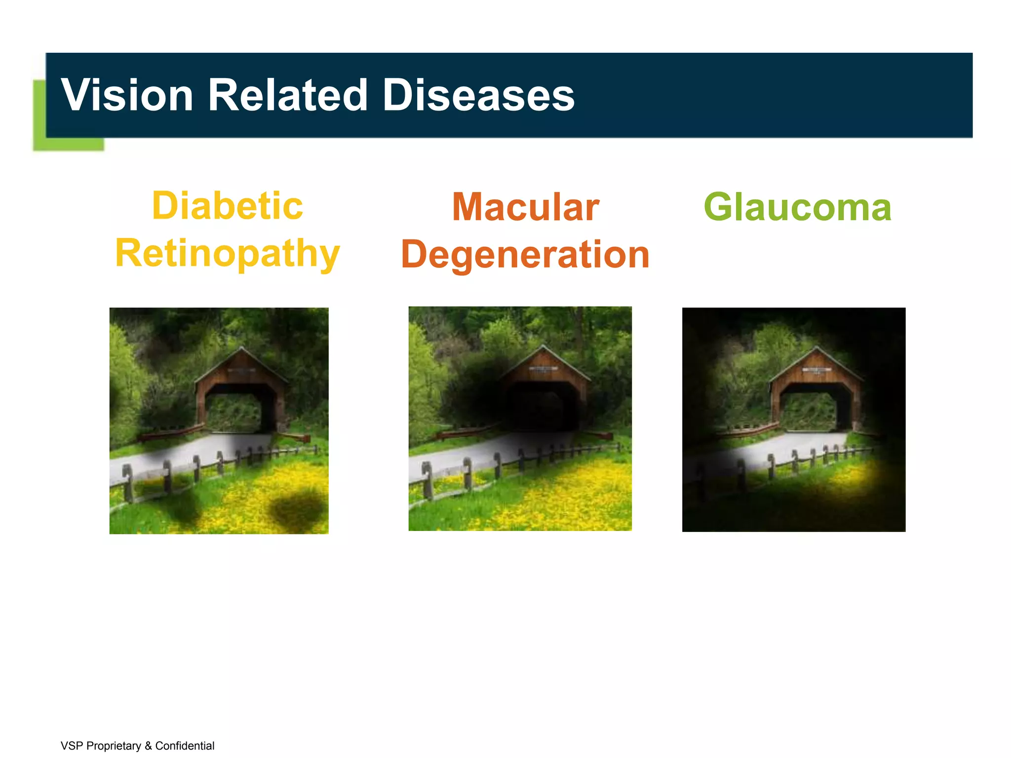 Jeremy Chadwick , VSP Vision Care | PPTX | Eye and Vision Conditions ...