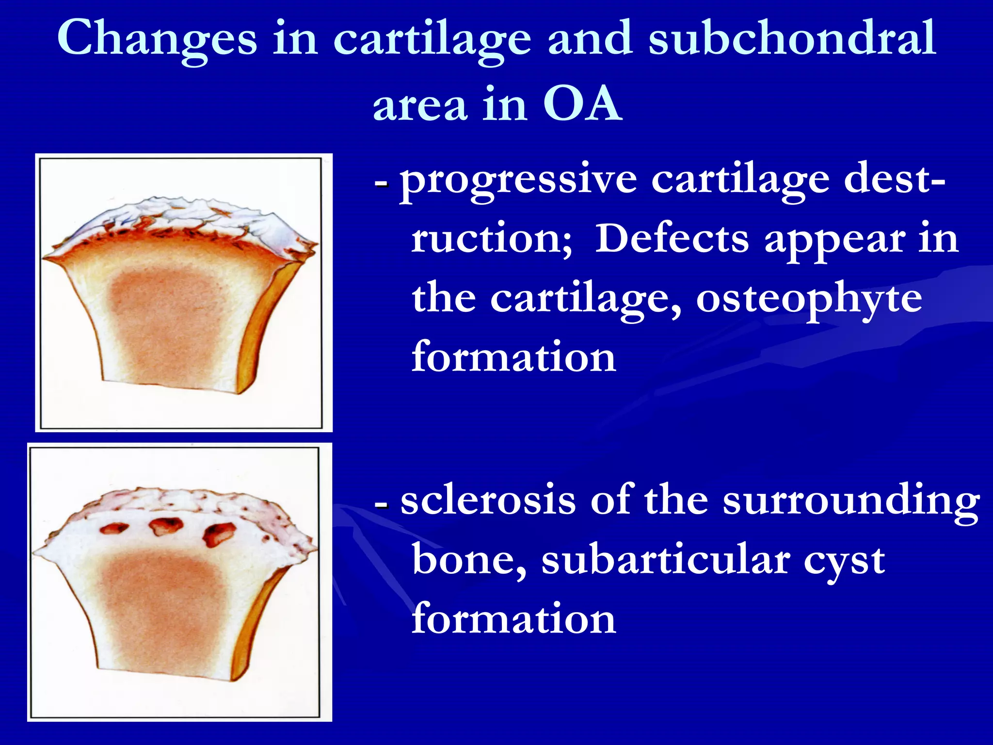 Osteoarthritis & Spondylitis | PPT