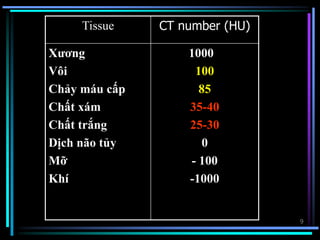 hình ảnh ct trong đột quỵ | PPT