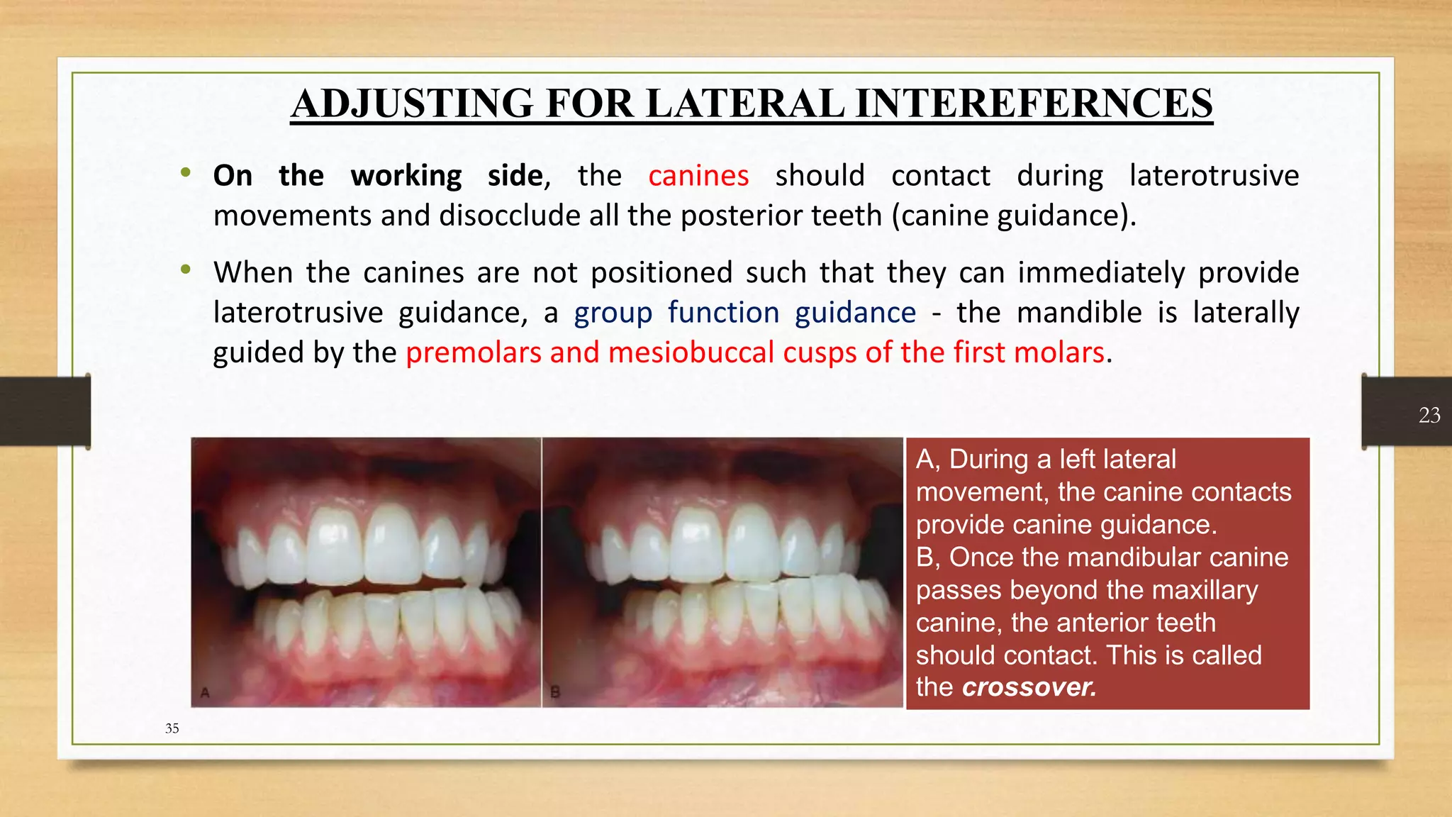 Occlusal equilibration - Kelly | PPTX
