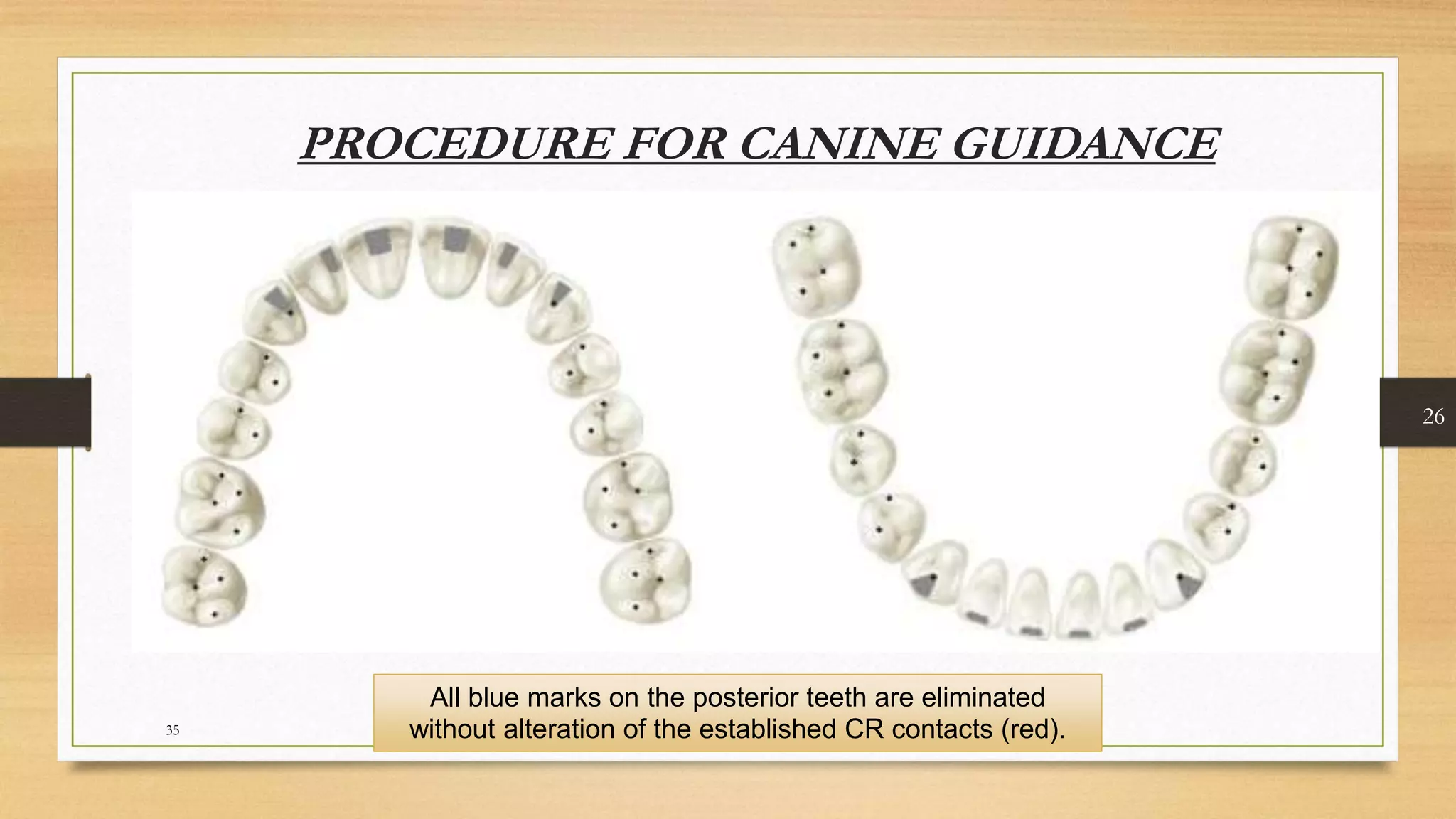 Occlusal equilibration - Kelly | PPTX