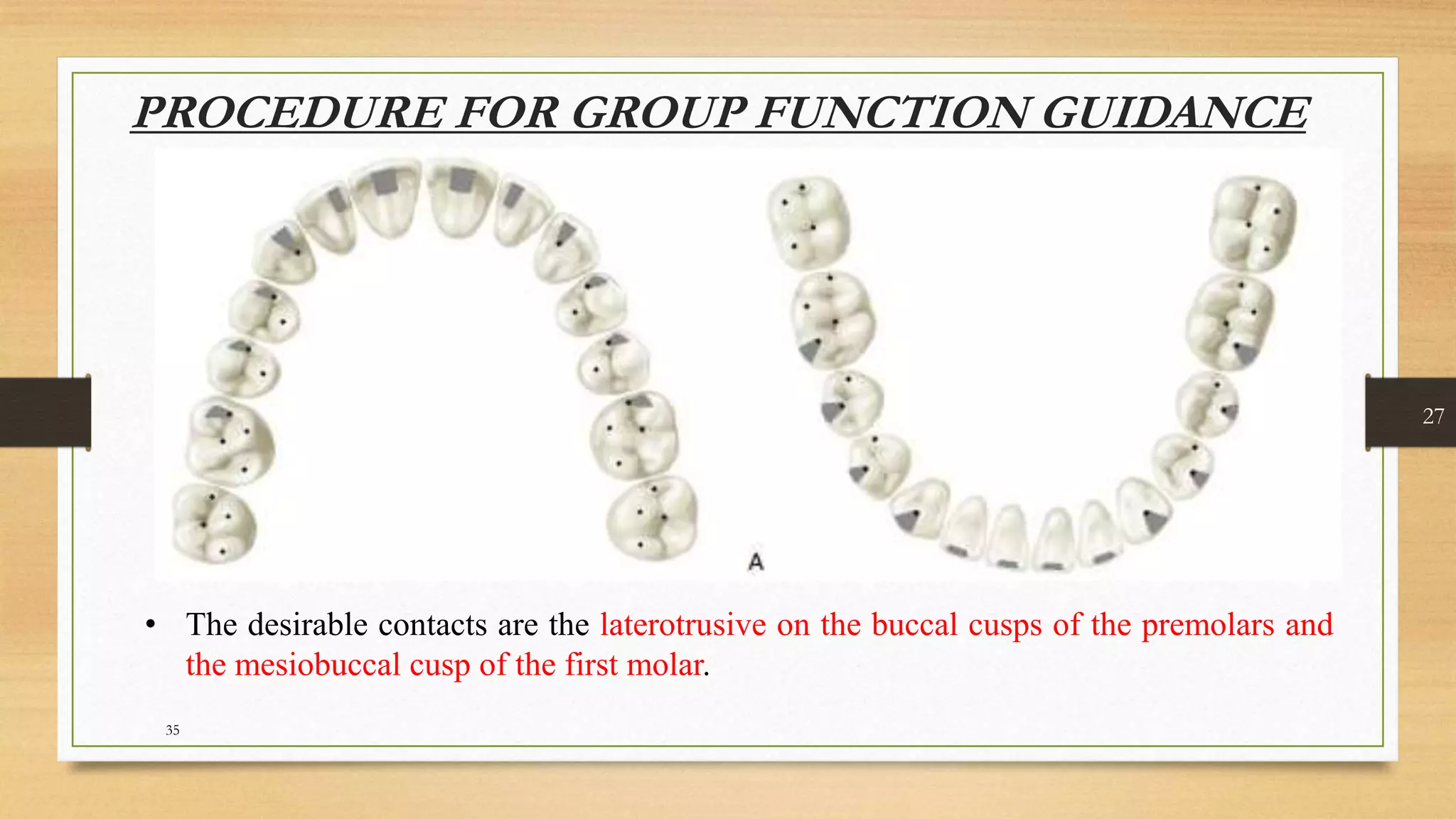 Occlusal equilibration - Kelly | PPTX