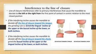 Occlusal equilibration - Kelly | PPTX