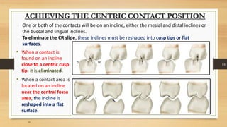 Occlusal equilibration - Kelly | PPTX