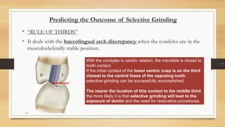 Occlusal equilibration - Kelly | PPTX