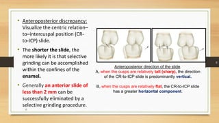Occlusal equilibration - Kelly | PPTX