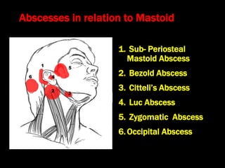 Complications of csom