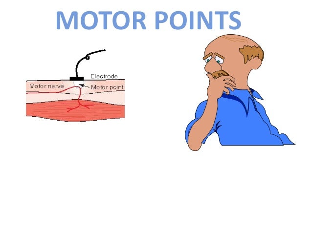 motor point