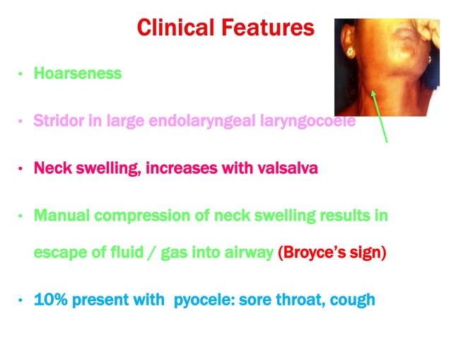 Benign lesions of larynx | PPT | Ear, Nose and Throat Conditions ...