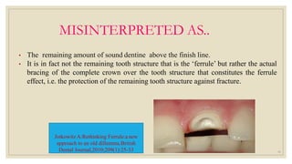 Ferrule effect | PPSX