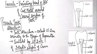 Ferrule effect | PPSX