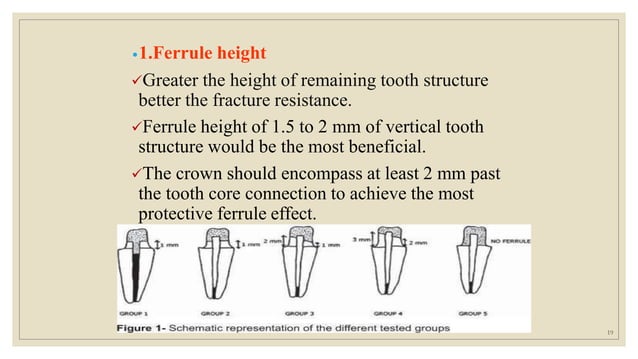 Ferrule effect | PPSX | Dental Health | Diseases and Conditions