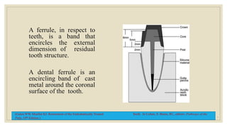 Ferrule effect | PPSX | Dental Health | Diseases and Conditions