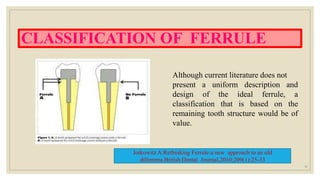 Ferrule effect | PPT