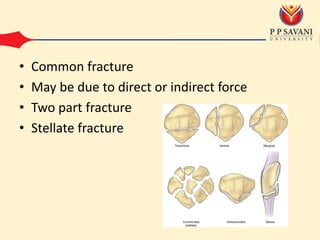 14. Injuries around knee | PPTX