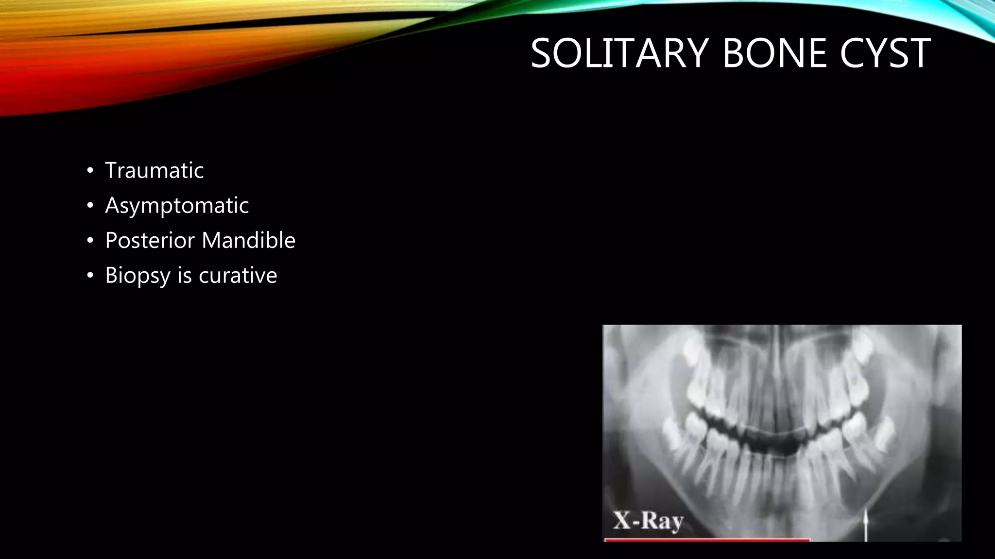 Management of Cysts | PPTX