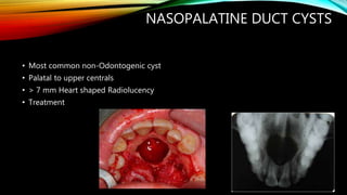 Management of Cysts | PPTX