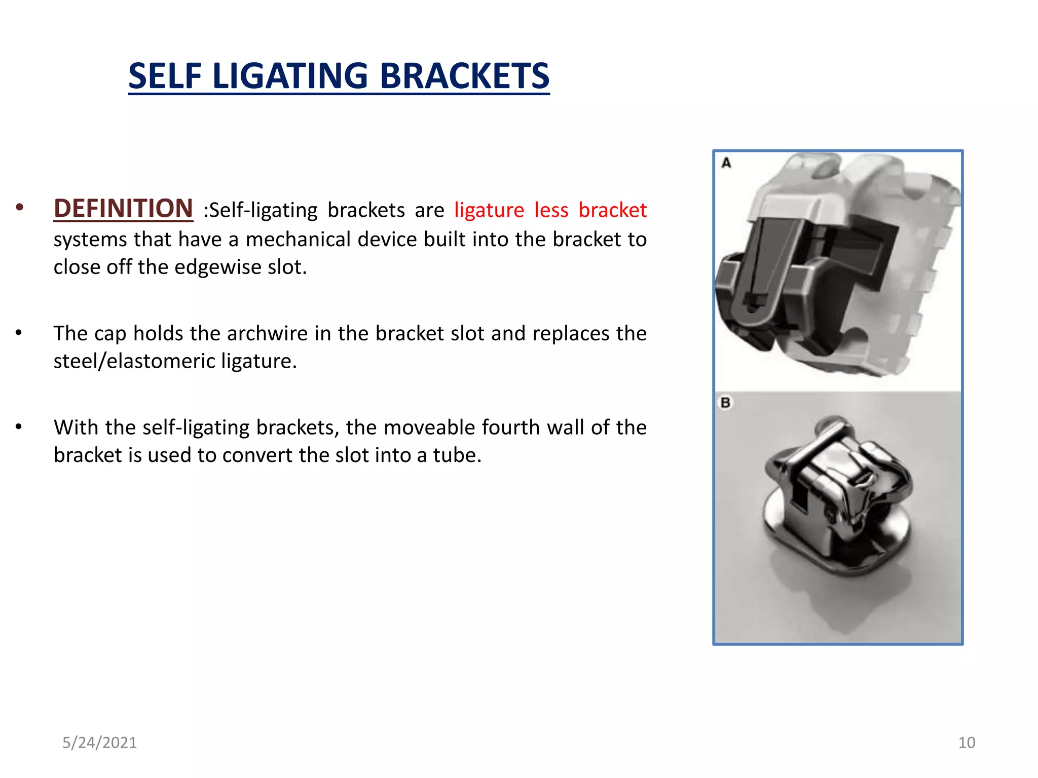 SELF LIGATING BACKETS | PPTX