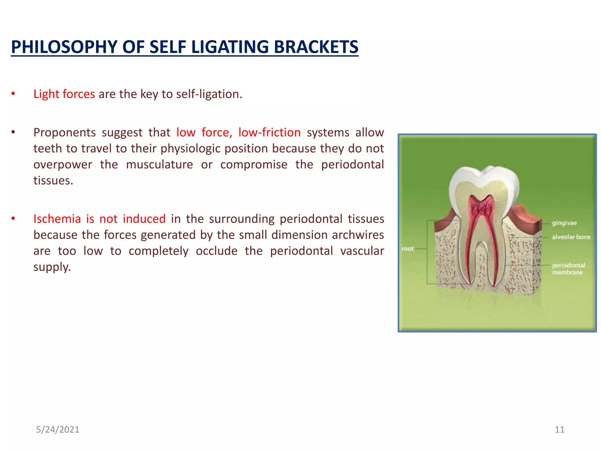 SELF LIGATING BACKETS | PPTX