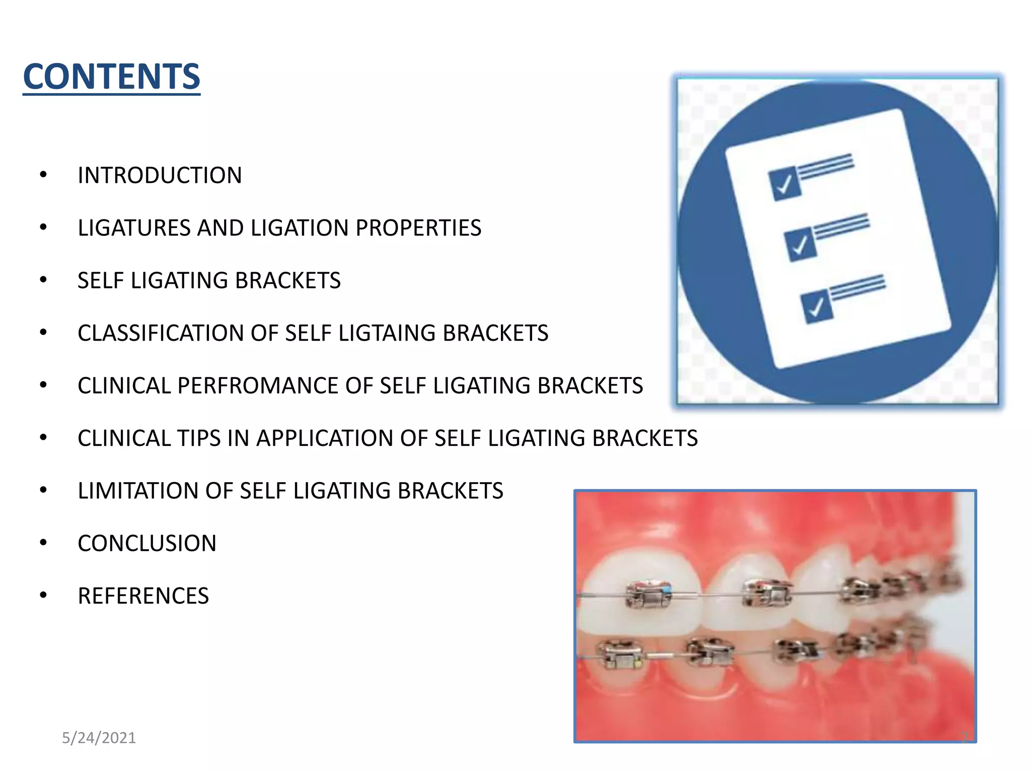 SELF LIGATING BACKETS | PPTX