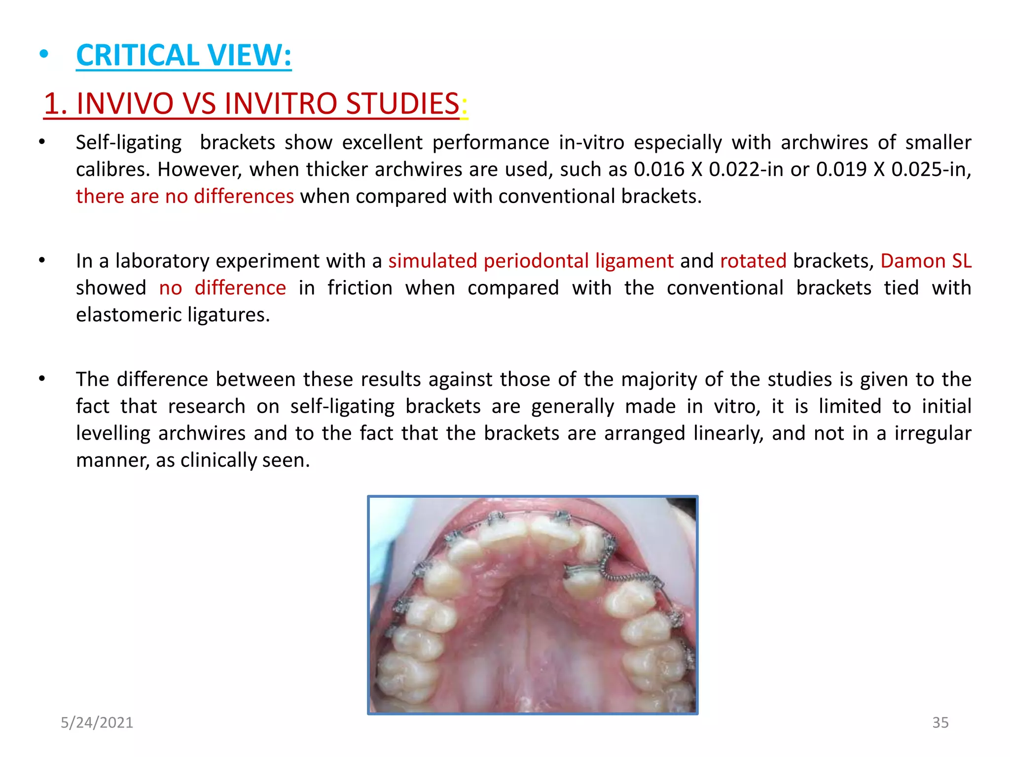 SELF LIGATING BACKETS | PPTX