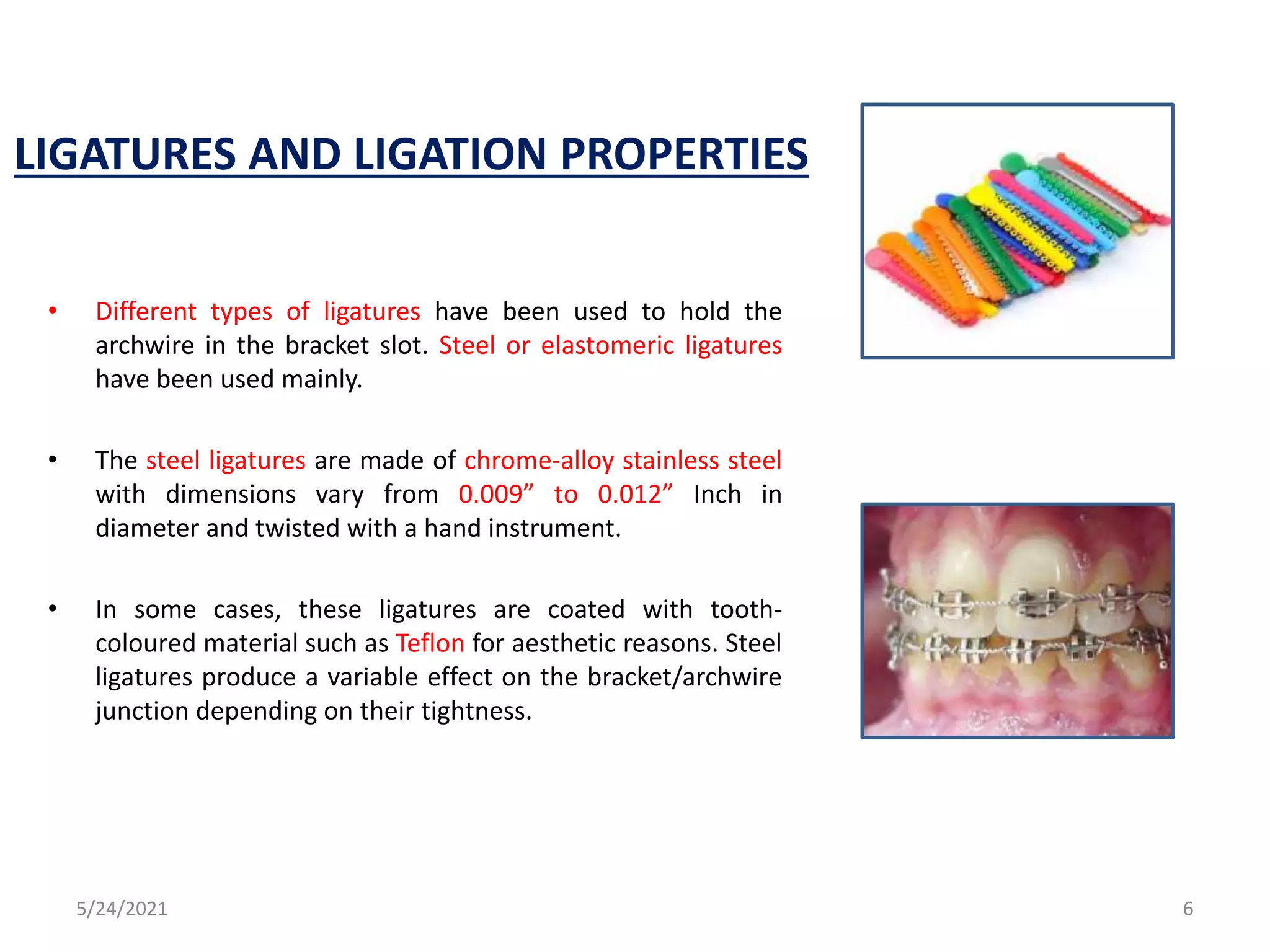 SELF LIGATING BACKETS | PPTX