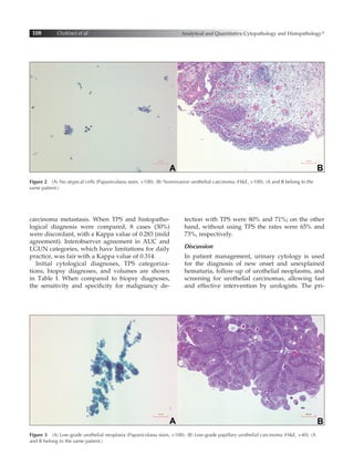 Is the Paris System Sufficient for Reporting Urinary Cytology? | PDF