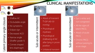 14. Primary glaucoma.pptx