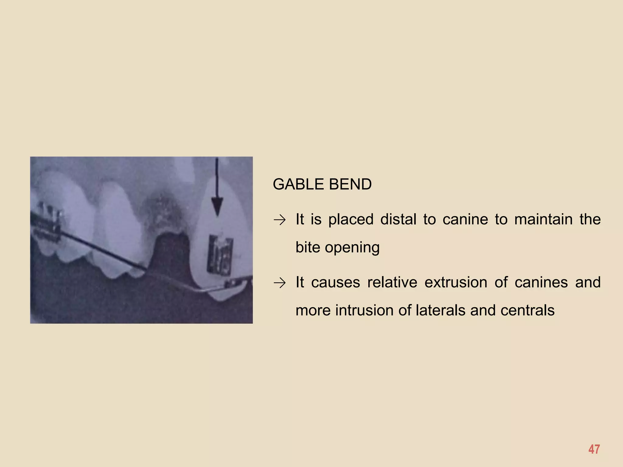 14. Refined and Modifie Begg.pptx