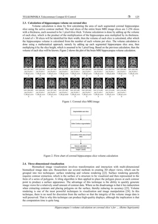 Hippocampus’s volume calculation on coronal slice’s for strengthening the diagnosis of Alzheimer ...