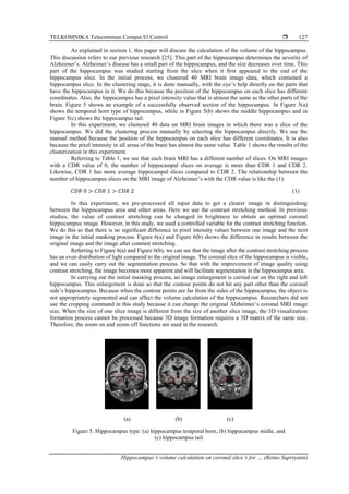 Hippocampus’s volume calculation on coronal slice’s for strengthening the diagnosis of Alzheimer ...