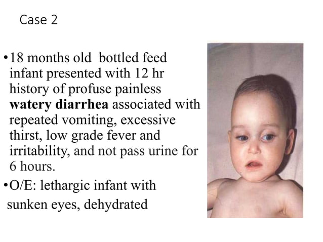 14.Acute diarrhea.pdf
