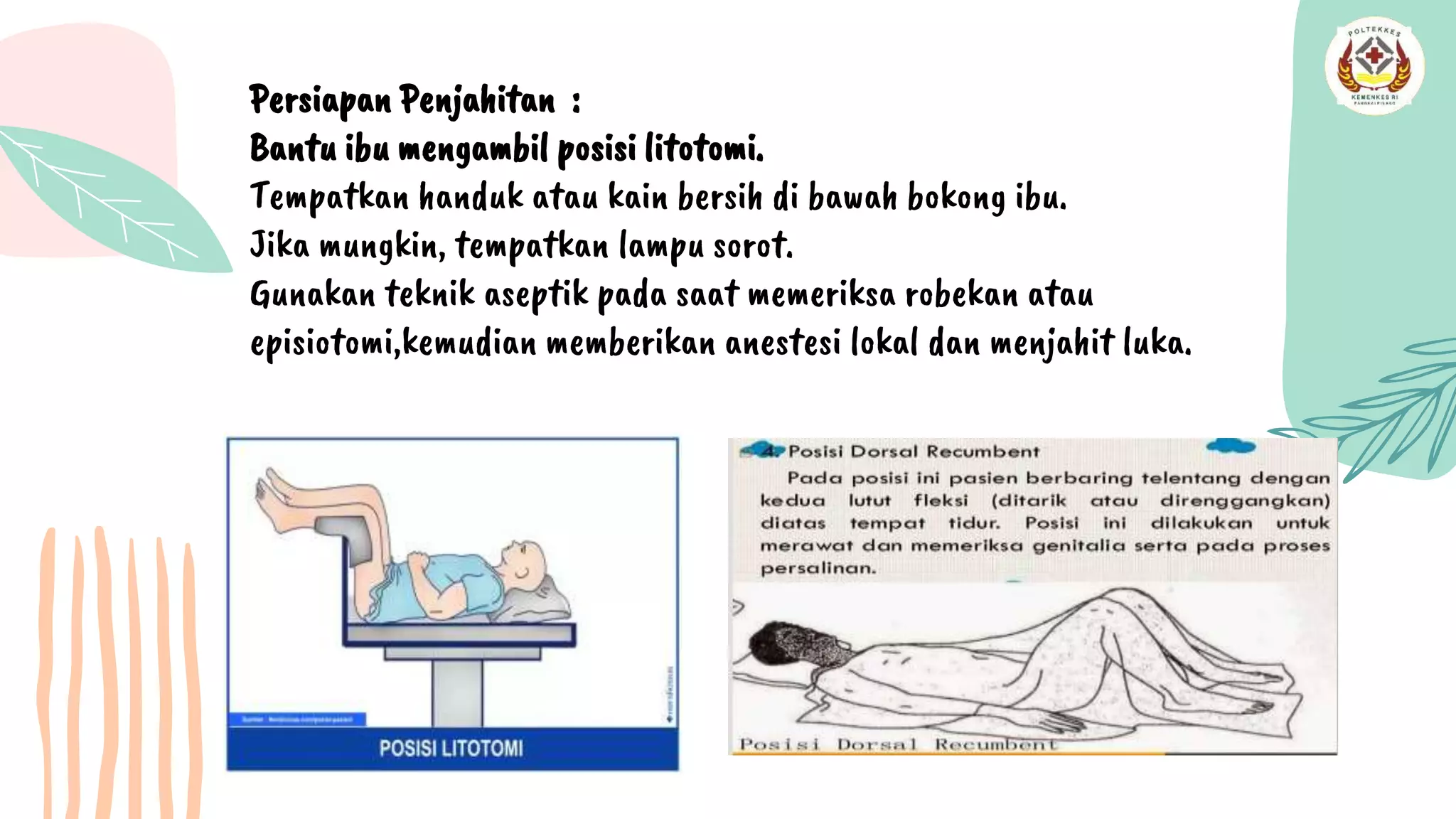 Amniotomi, Episiotomi, Penjahitan Perineum | PPTX