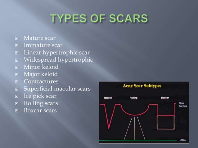 Scar Revision in oral and Maxillofacial Surgery | PPT