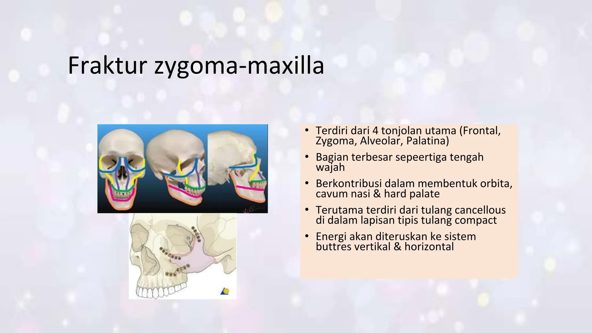 Kuliah Kedokteran Trauma tulang wajah powerpoint | PPTX