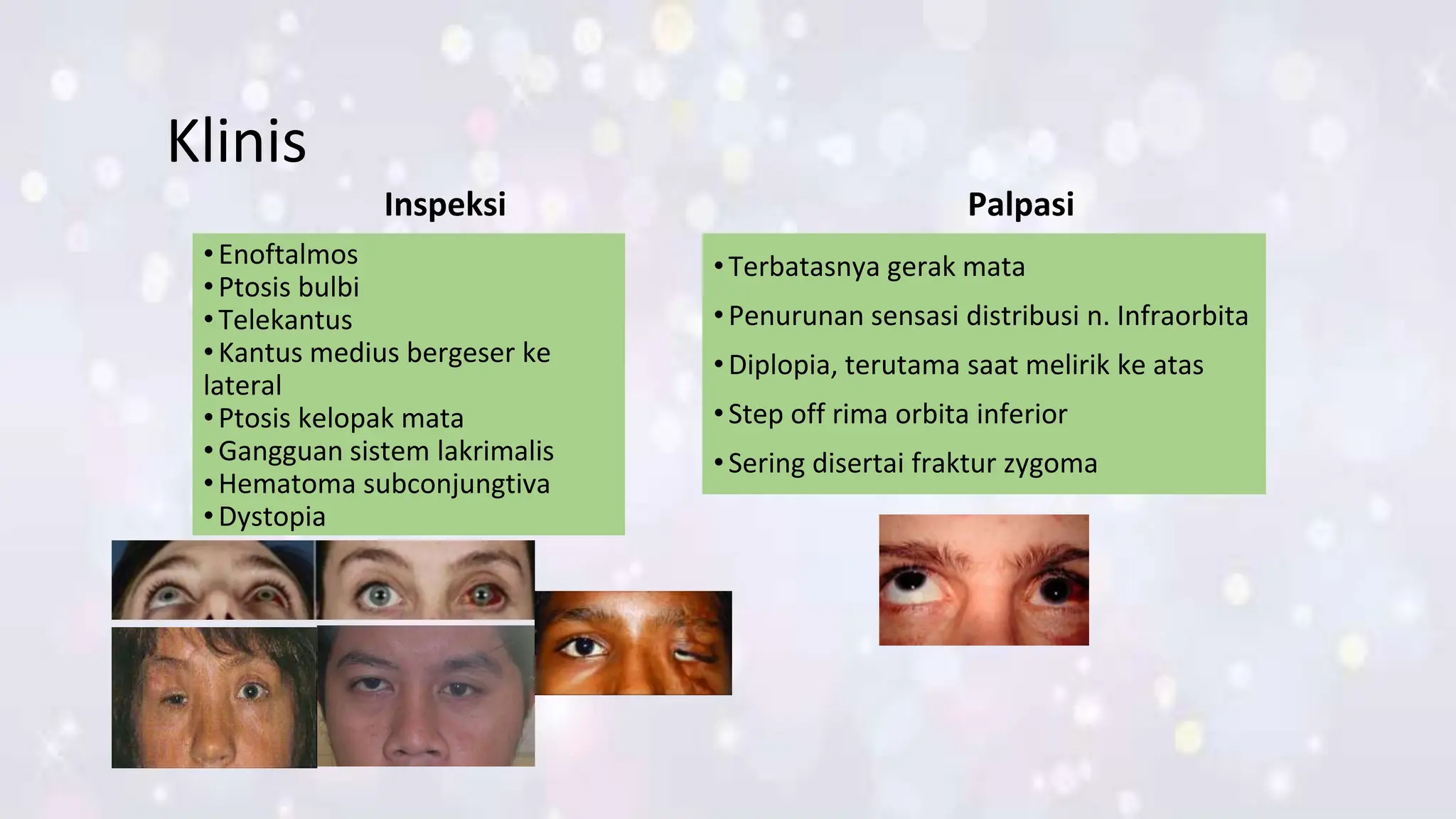 Kuliah Kedokteran Trauma tulang wajah powerpoint | PPTX