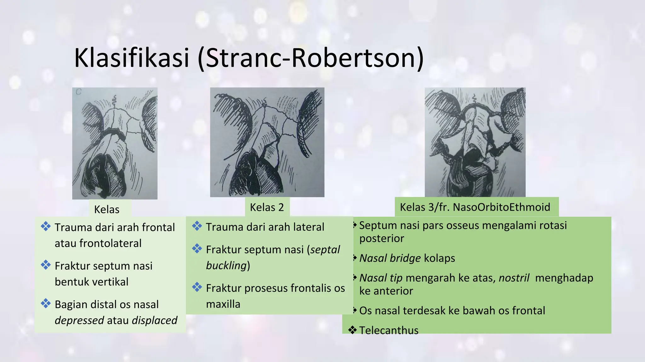 Kuliah Kedokteran Trauma tulang wajah powerpoint | PPTX