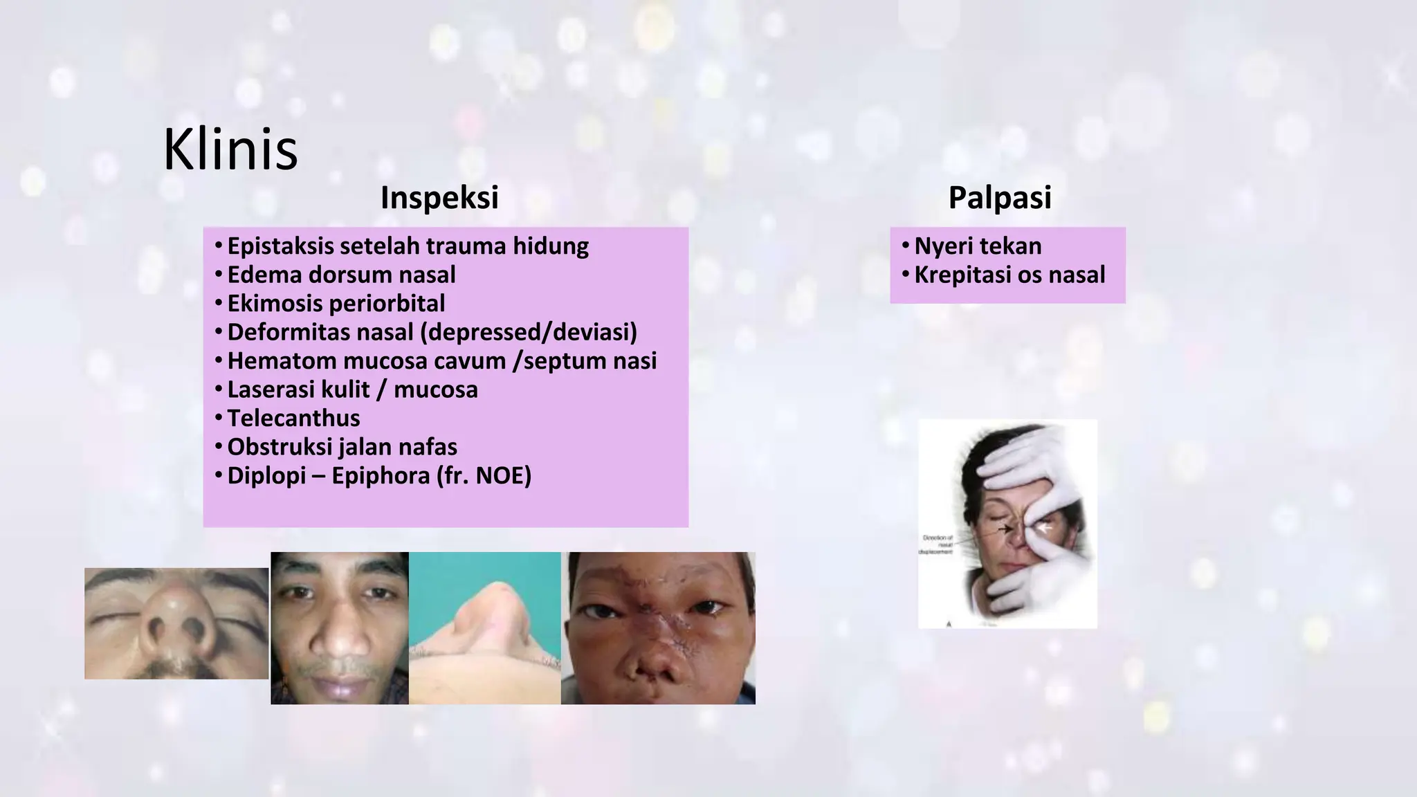 Kuliah Kedokteran Trauma tulang wajah powerpoint | PPTX