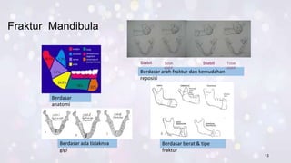 Kuliah Kedokteran Trauma tulang wajah powerpoint | PPTX