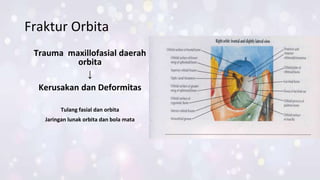 Kuliah Kedokteran Trauma tulang wajah powerpoint | PPTX