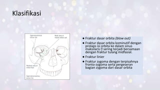 Kuliah Kedokteran Trauma tulang wajah powerpoint | PPTX