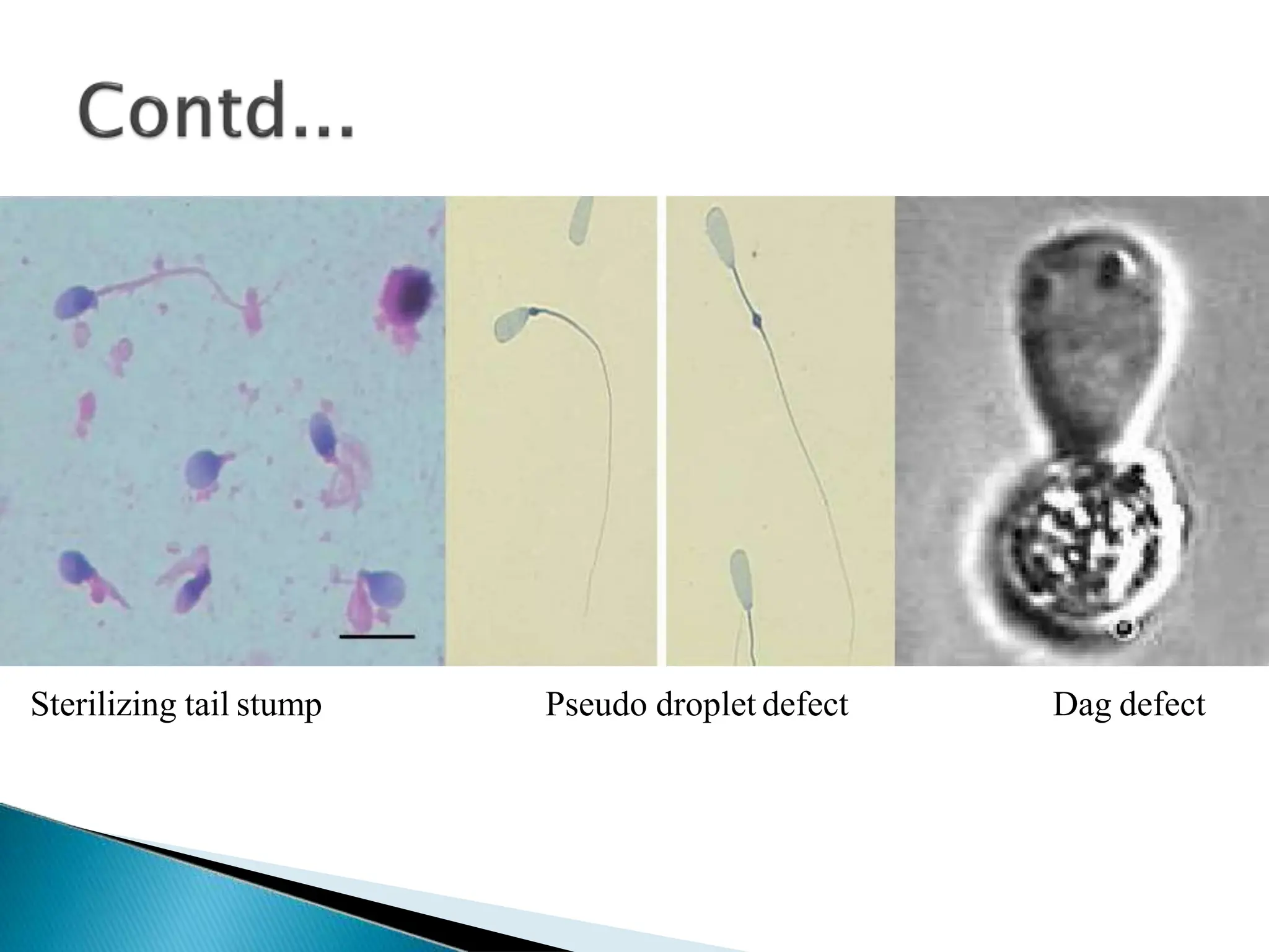 Causes of male infertility in cattle bull-.pptx