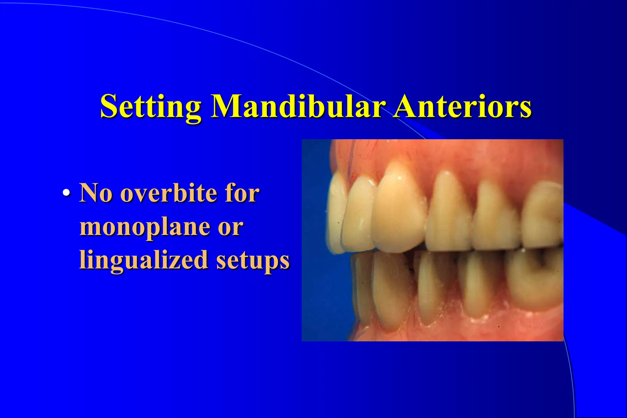 Setting Maxillary Anterior Teeth for aesthetics and phonetics.ppt