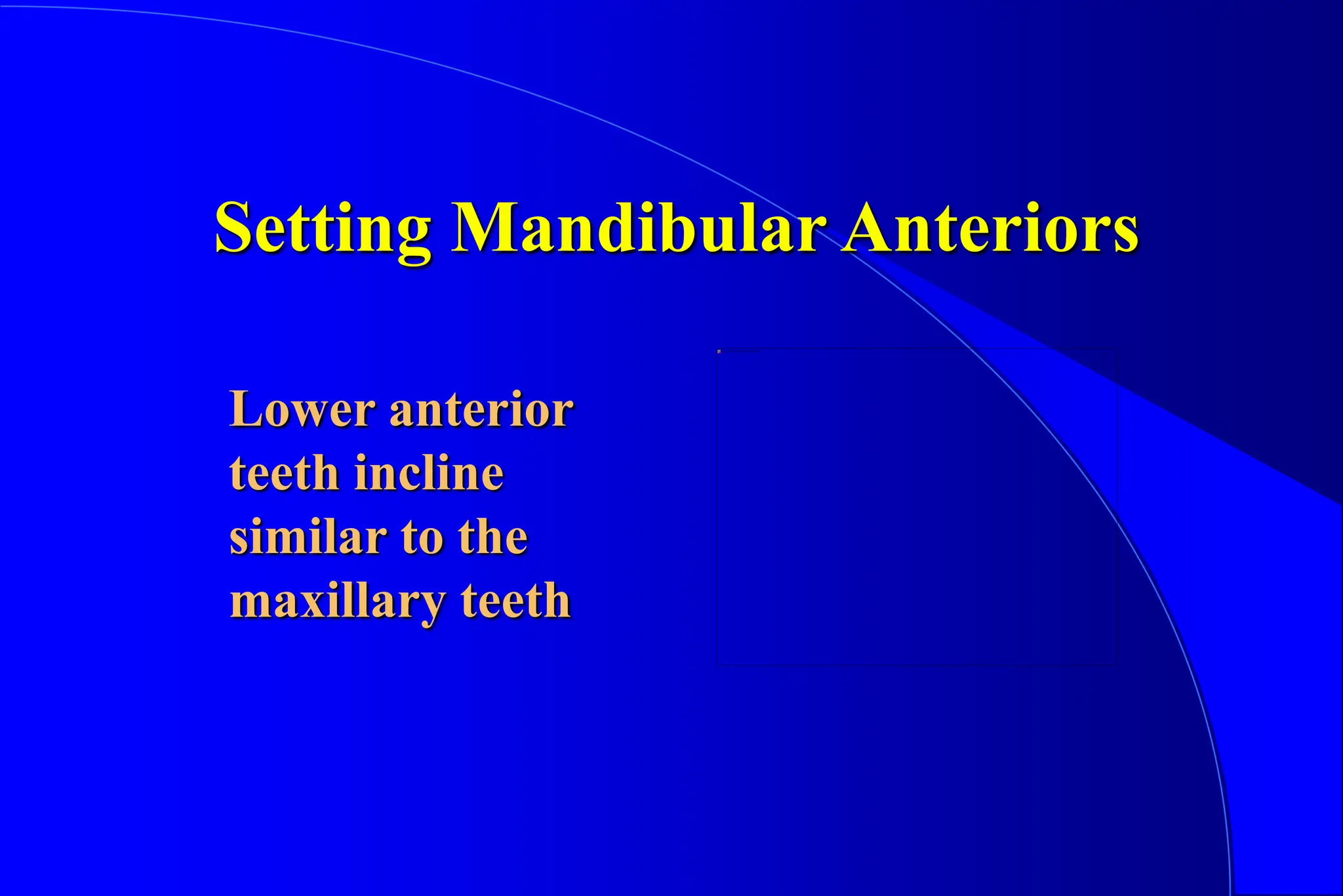 Setting Maxillary Anterior Teeth for aesthetics and phonetics.ppt